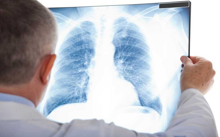 The Evolution Of Radiology: A Historical Perspective | Healthpostinfo.com